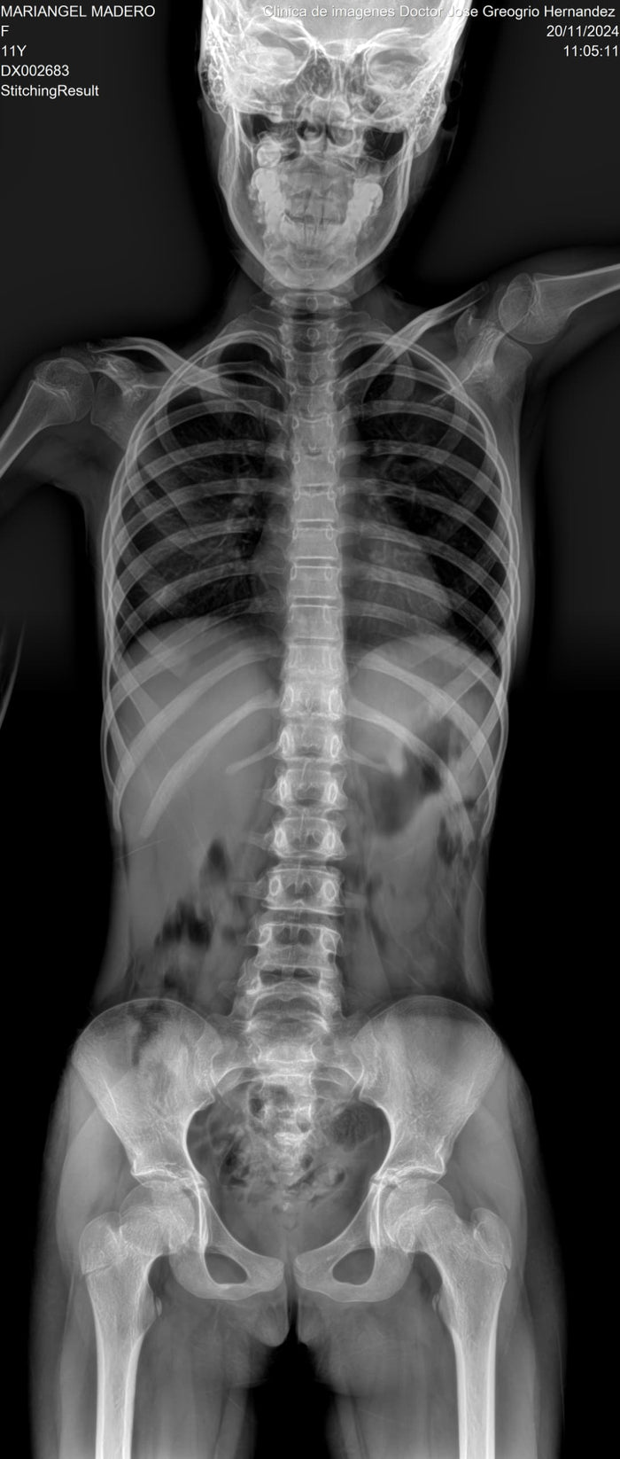 Kit de rayos X y Flat panel portátil | Milectron y Advanced – Solmedicven