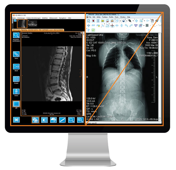 eFilm Workstation | Estación de trabajo eFilm | Software de visualizac ...